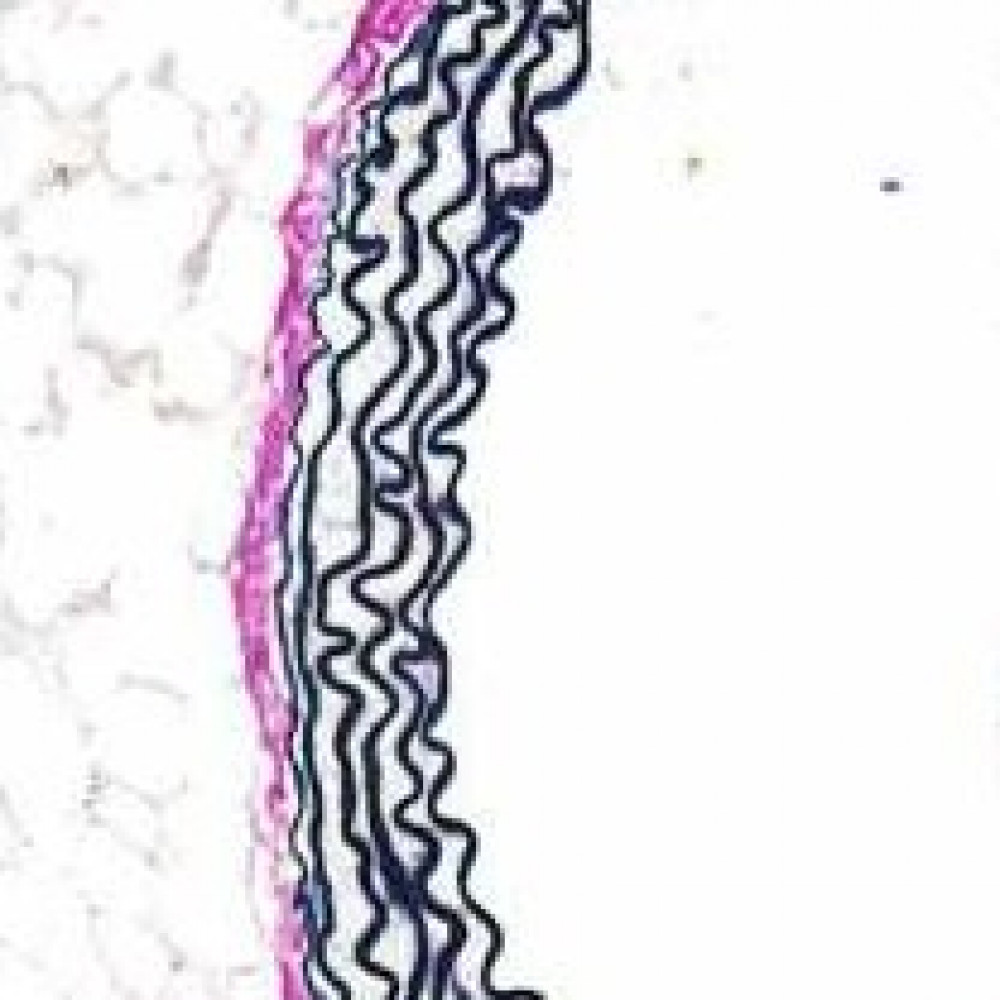 Elastic Stain Kit