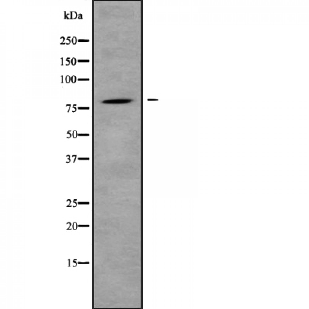 Rabbit IL31R Antibody, Polyclonal