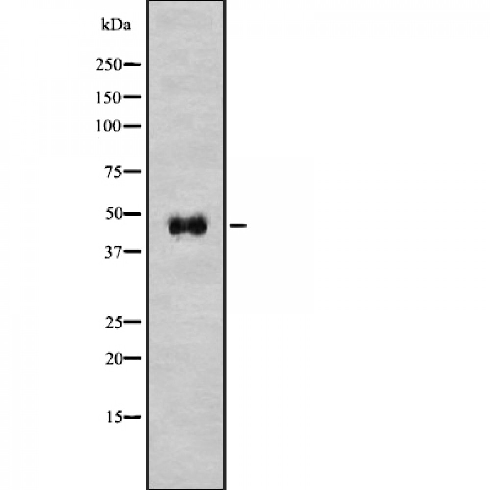 Rabbit PAFAH1B1 Antibody, Polyclonal